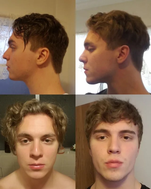 PHƯƠNG PHÁP MEWING CÓ THẬT SỰ HIỆU QUẢ? - Trải Nghiệm Sống